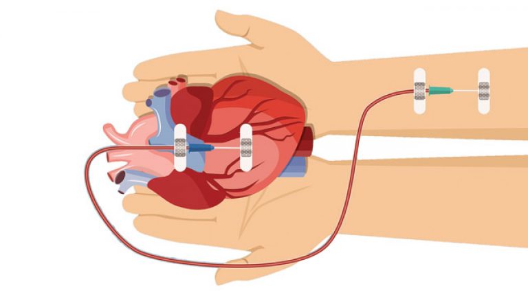 Organ Donation Benefits Myths And Facts Redcare 4267